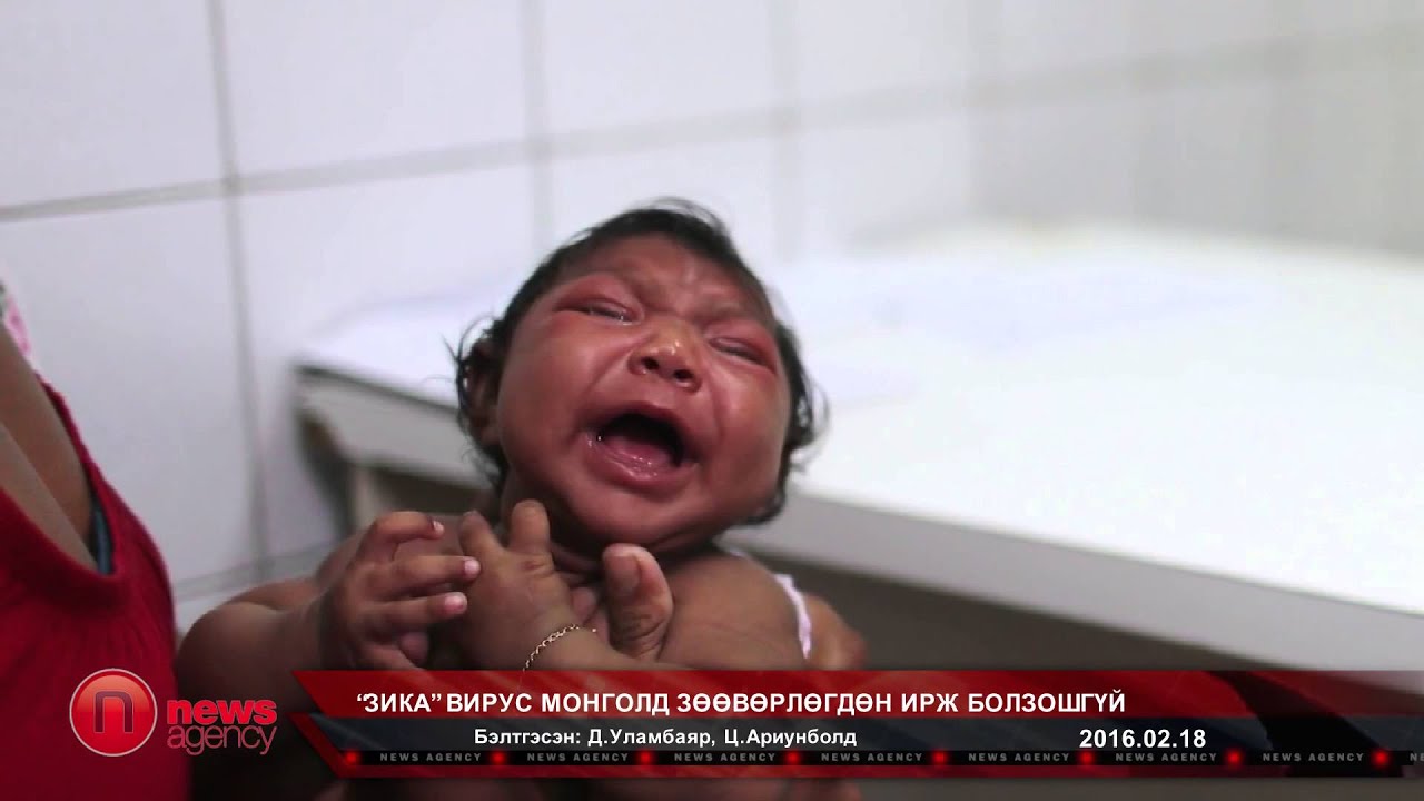 ЗИКА ВИРУС МОНГОЛД ЗӨӨВӨРЛӨГДӨН ИРЖ БОЛЗОШГҮЙ 02 18 Youtube