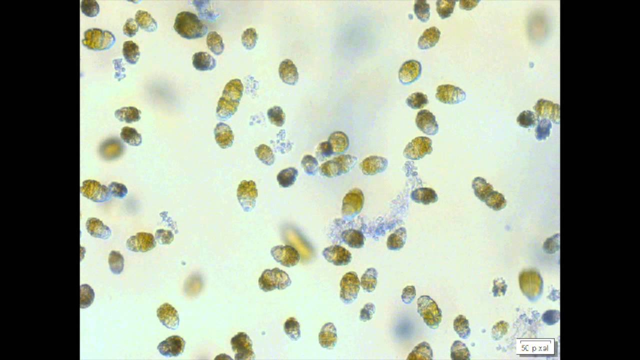 Cochlodinium polykrikoides - YouTube