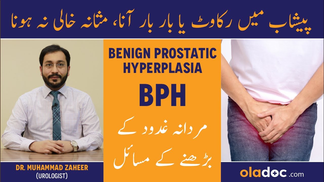 Benign Prostatic Hyperplasia (BPH) Treatment - Mardana Ghadood Barh ...