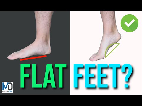 Flexible vs Rigid Flat Feet: Know the Difference