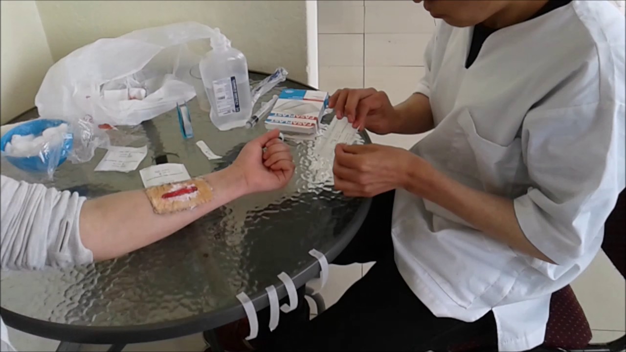 curación de heridas paso a paso. IP CHILE - YouTube