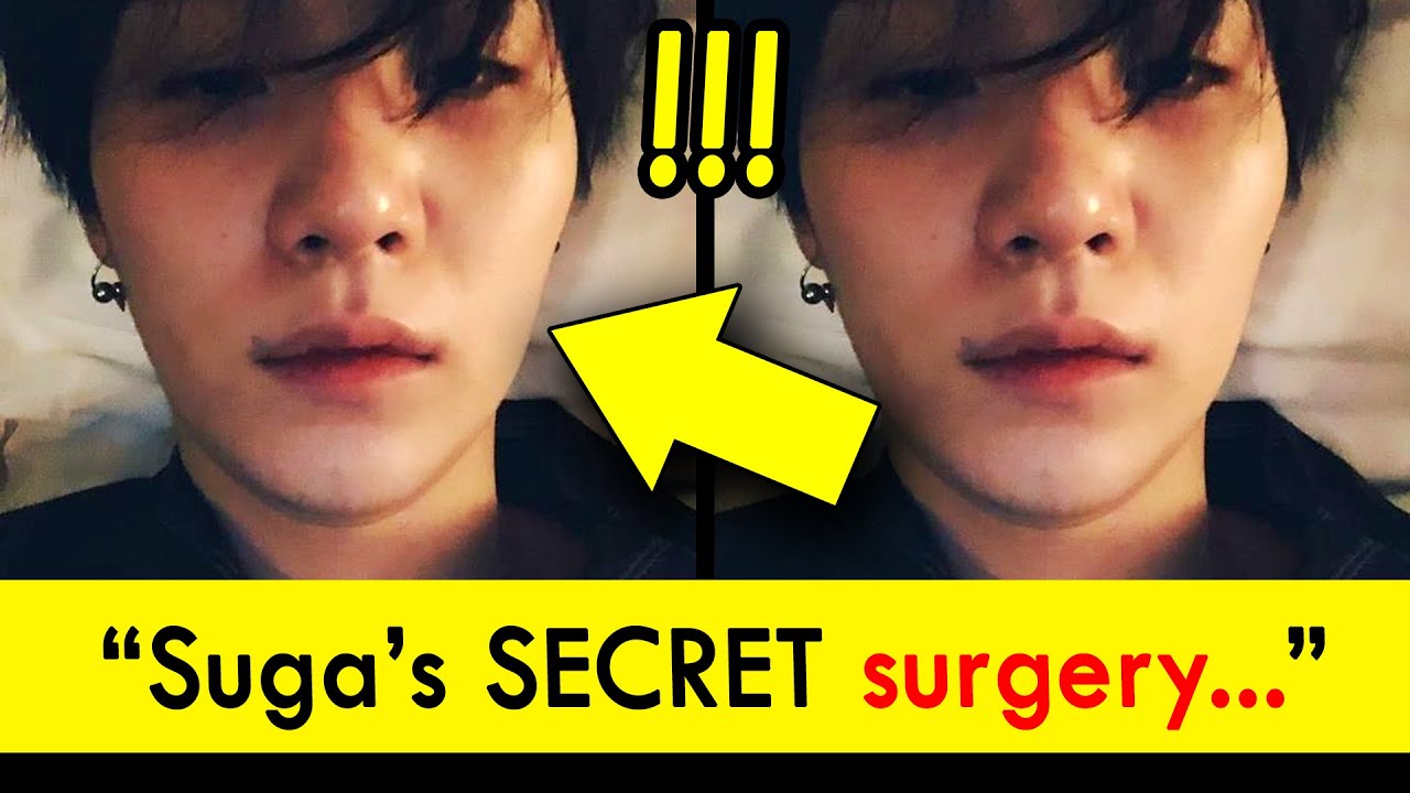 Suga's SECRET surgery...!! Unhelpful guide to Park Jimin - YouTube