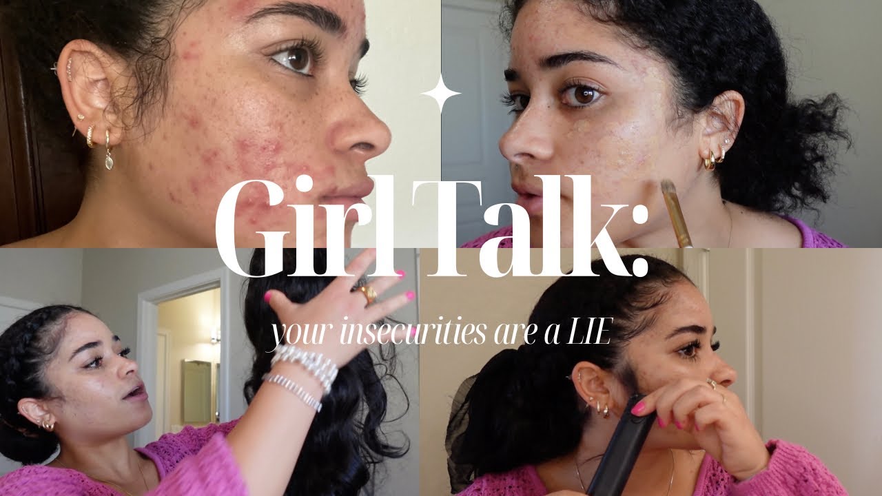 Girl Talk🗣️💕: self-love, dealing with insecurities + my acne story ...