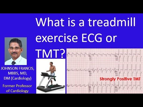 What is a treadmill exercise ECG or TMT? - YouTube