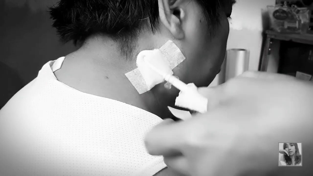 Dressing my moms IJ (internal jugular) catheter - YouTube