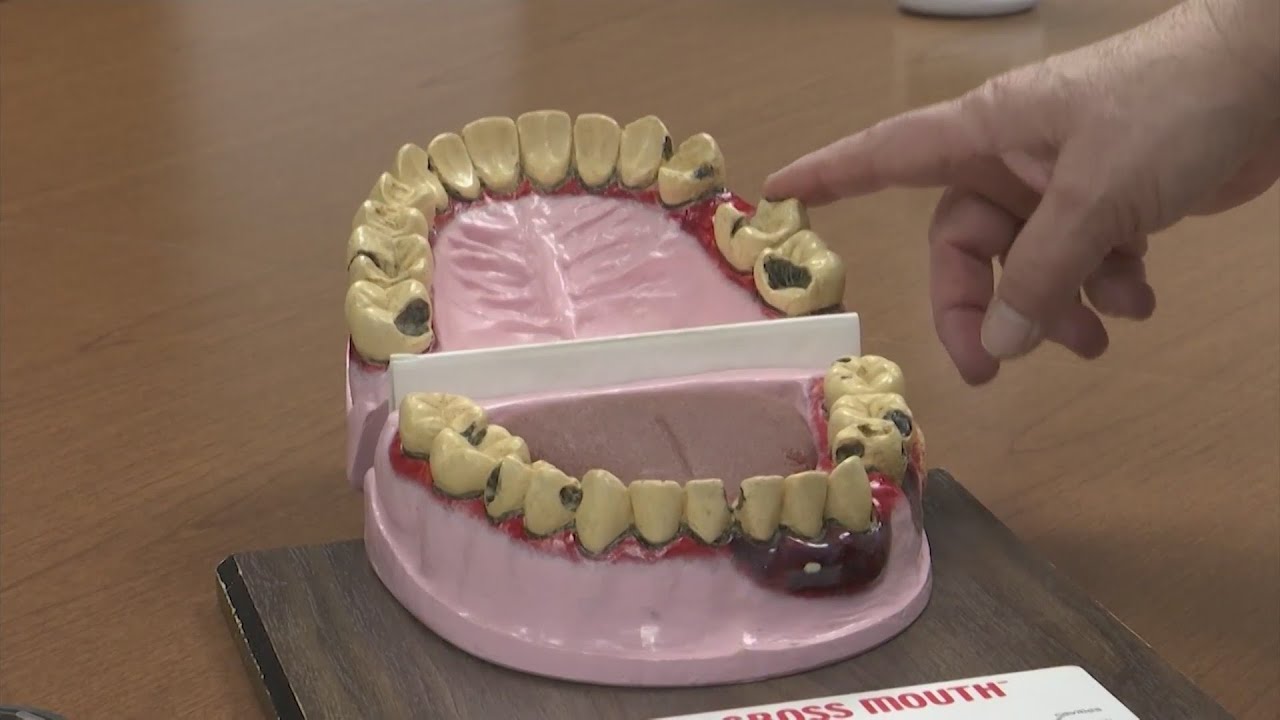 ‘Through With Chew’ reminds tobacco users of dangers - YouTube