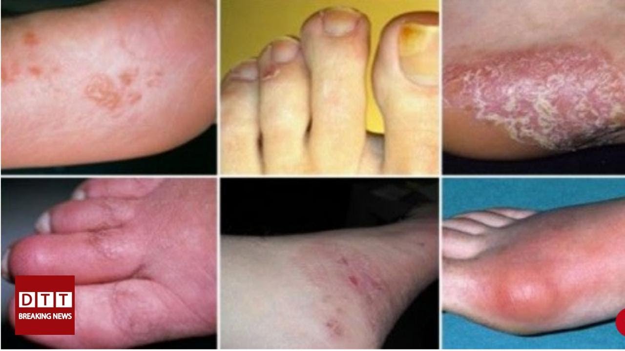 Regardez vos pieds ! Voici 10 signes qui peuvent indiquer un problème ...