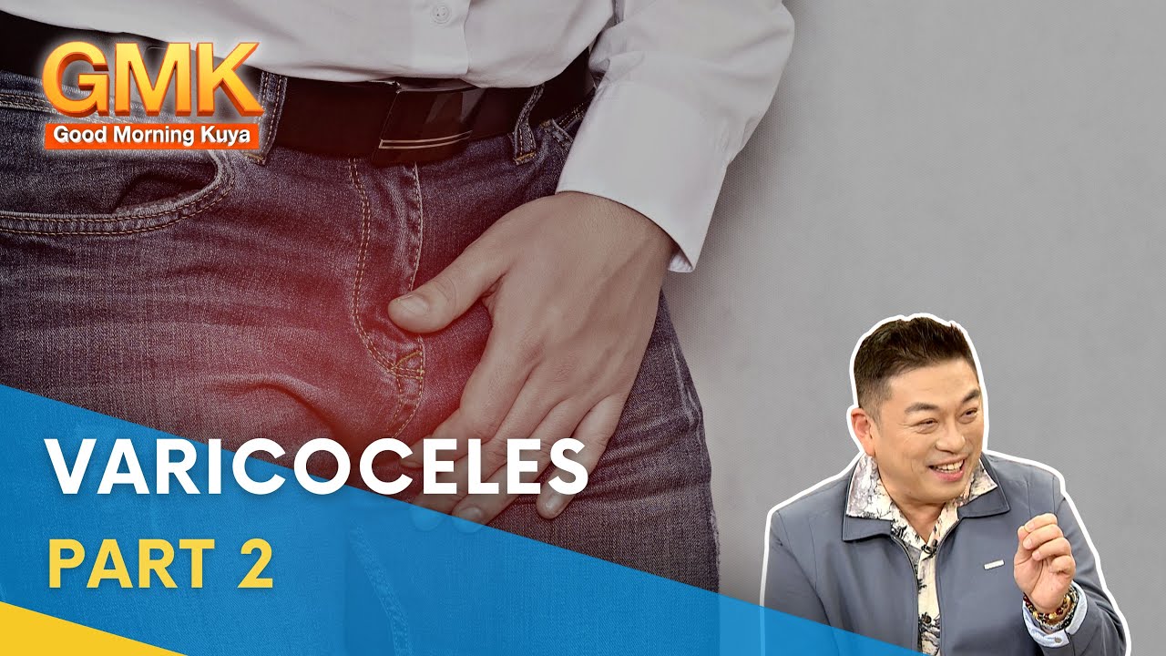 Varicoceles: Symptoms, Diagnosis, and Treatment (Part 2/3) | Usapang ...
