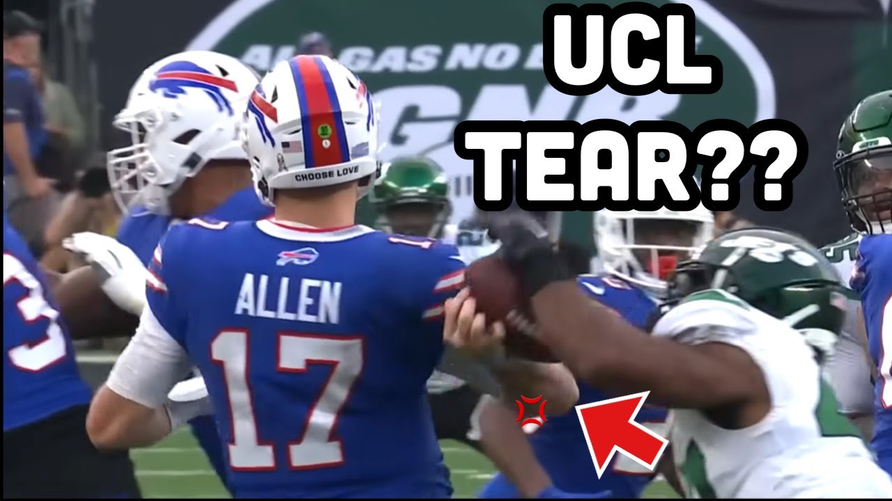 Josh Allen UCL Injury - DOCTOR Explains Prognosis - YouTube