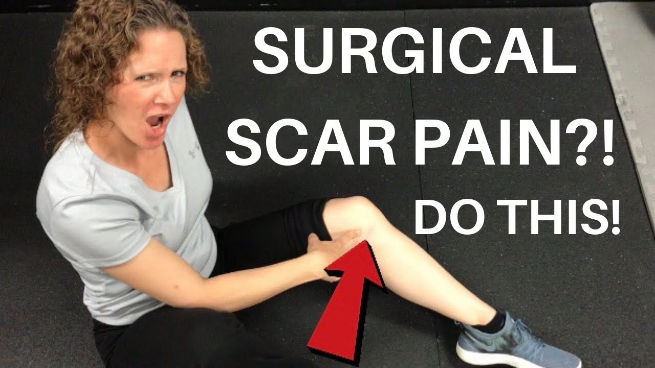 SURGICAL SCAR PAIN & DECREASED RANGES OF MOTION?! DO THIS! - YouTube