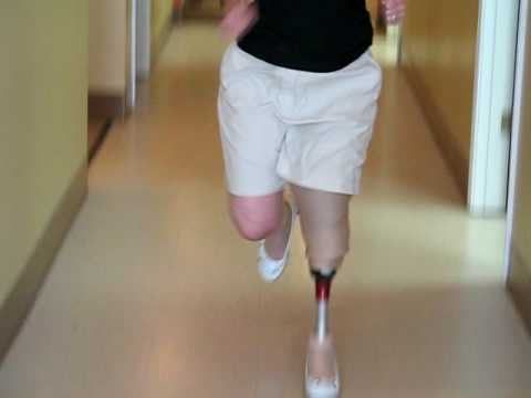 Left BKA Below Knee Amputee running-Spears Prosthetics - YouTube