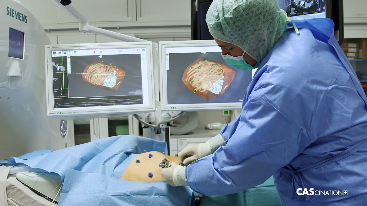 Quality Ablation - Reproducible and Standardized Liver Tumour Treatment ...