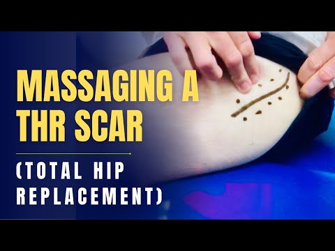 How To Massage A Scar After Hip Replacement Surgery