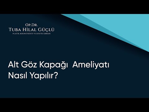 Alt Göz Kapağı Ameliyatı Nasıl Yapılır?