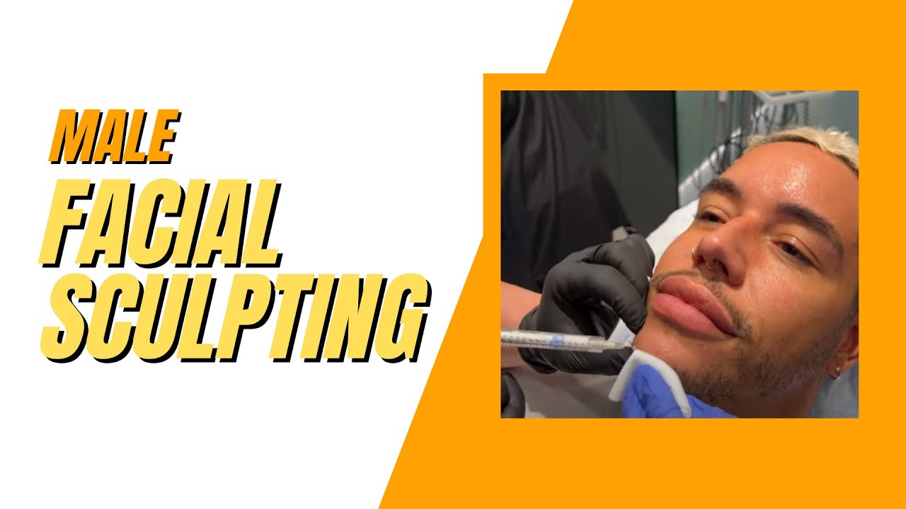 MALE FACIAL SCULPTING WITH SHARP ANGLES USING RADIESSE | Dr. Jason Emer ...