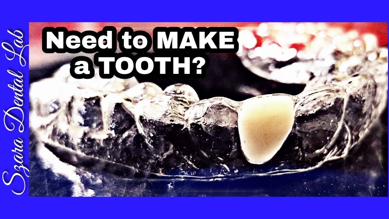 Invisible Retainer Pontic Tooth Lesson #97 Szara Dental - YouTube