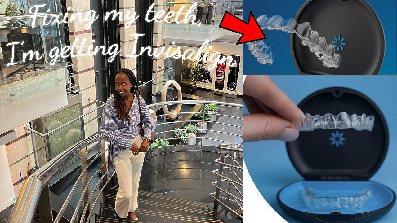 TRANSFORMING MY SMILE : MY INVISALIGN JOURNEY. - YouTube