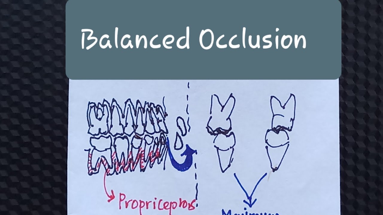 Balanced Occlusion (Part 1) - YouTube