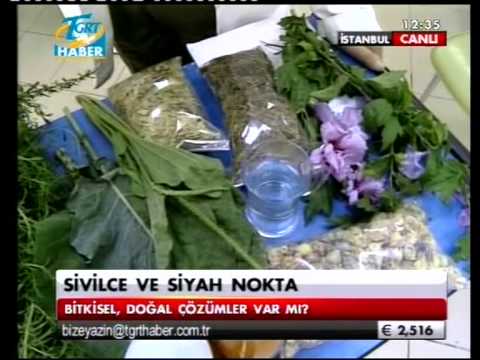 Sivilce ve Siyah Noktalara Bitkisel Çözüm