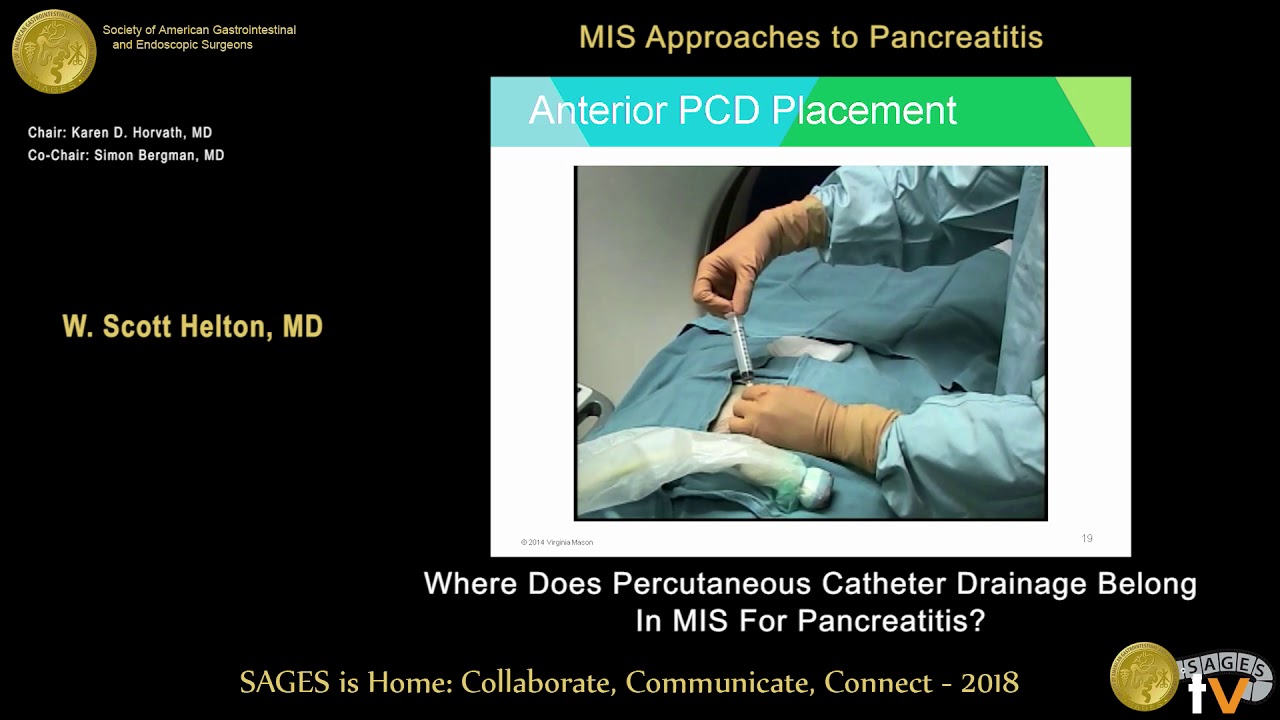 Where does catheter drainage belong in MIS for pancreatitis - YouTube