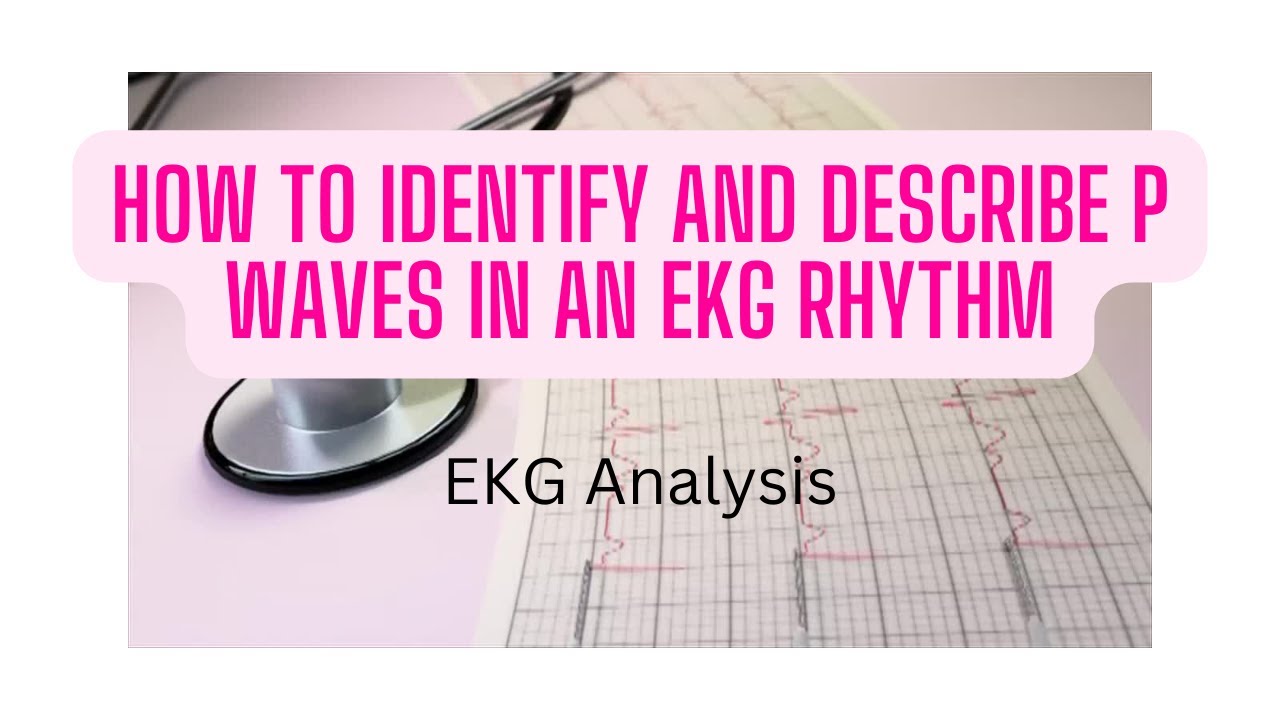 Identifying and describing P waves in an EKG rhythm - YouTube