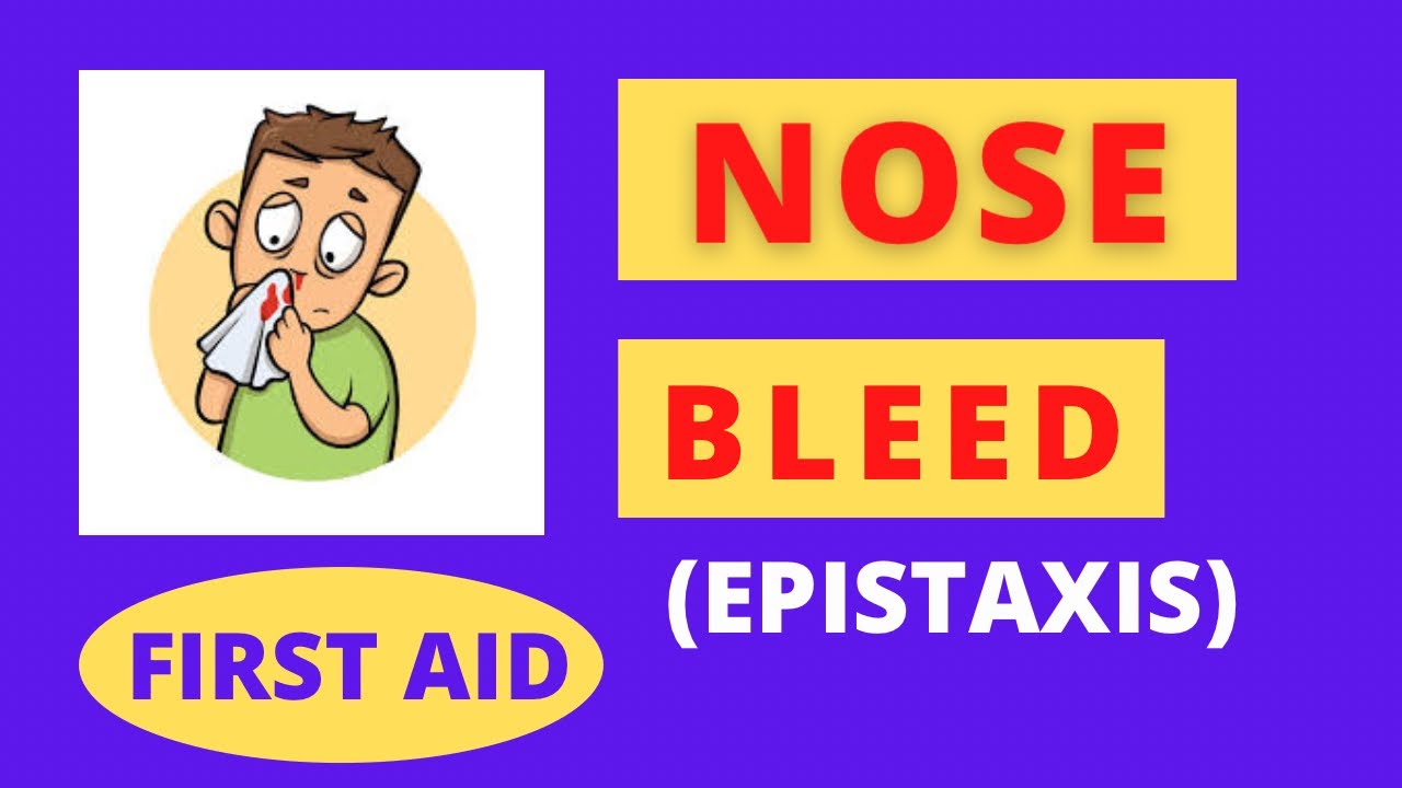 NOSE BLEED -Epistaxis in children. First aid. How to deal at home # ...