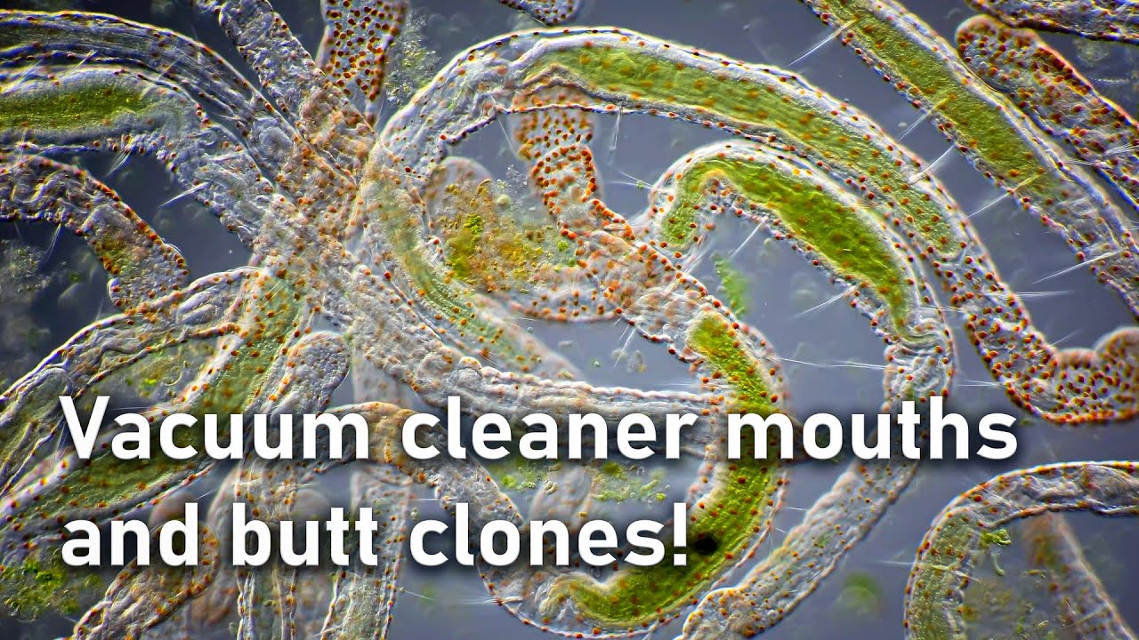 Microscopic Alien-Looking Worms - Under The Microscope - YouTube