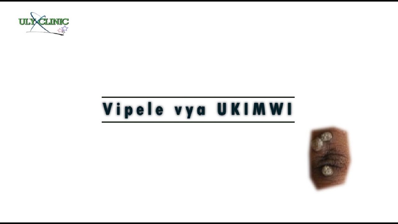 Vipele vya UKIMWI - YouTube