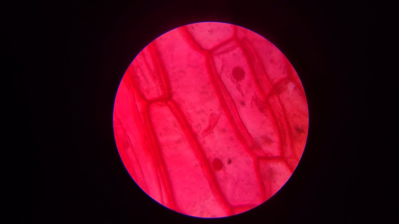 To prepare stained temporary mount of onion peel - YouTube