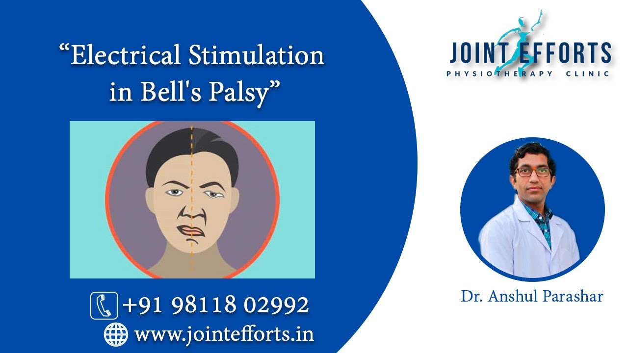 Electrical Stimulation in Bell's Palsy.. #physiotherapy #noida # ...
