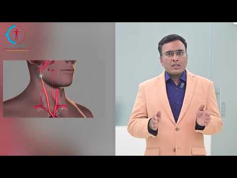 What is DSA?  (Digital Subtraction Angiography)