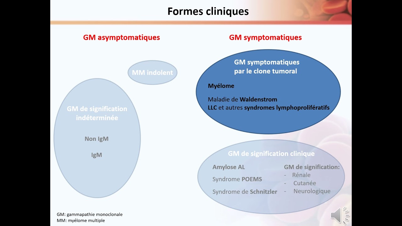 Introduction au cours de DES : Gammapathie monoclonale - YouTube