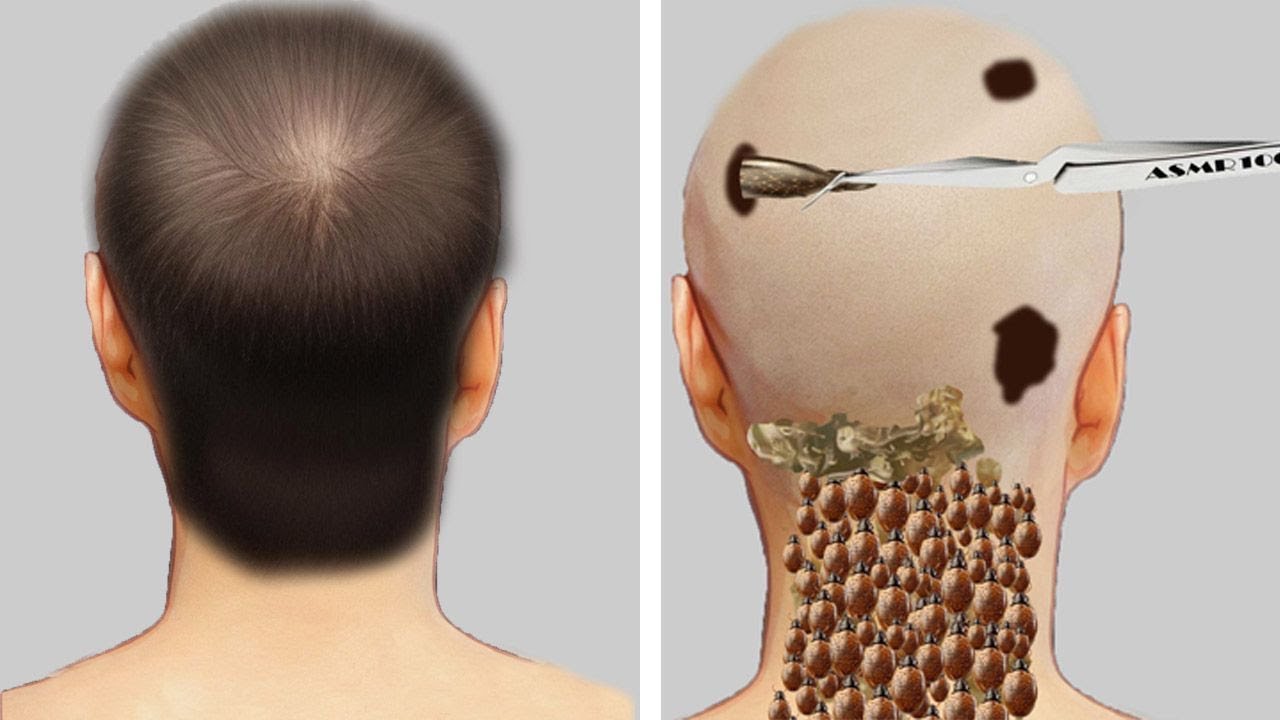 ASMR ANIMATION HEAD CLEANING TREATMENT - YouTube