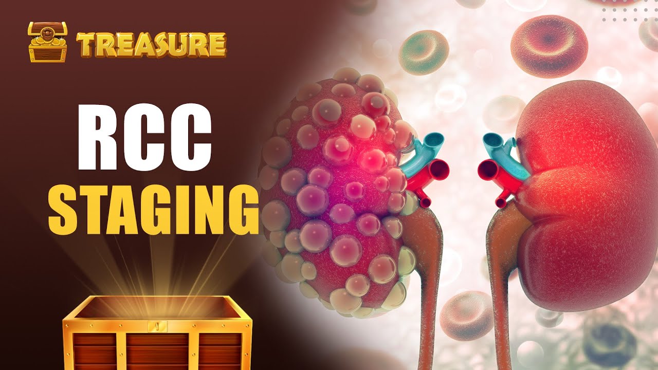 RCC Staging Explained - PrepLadder NEET SS - YouTube