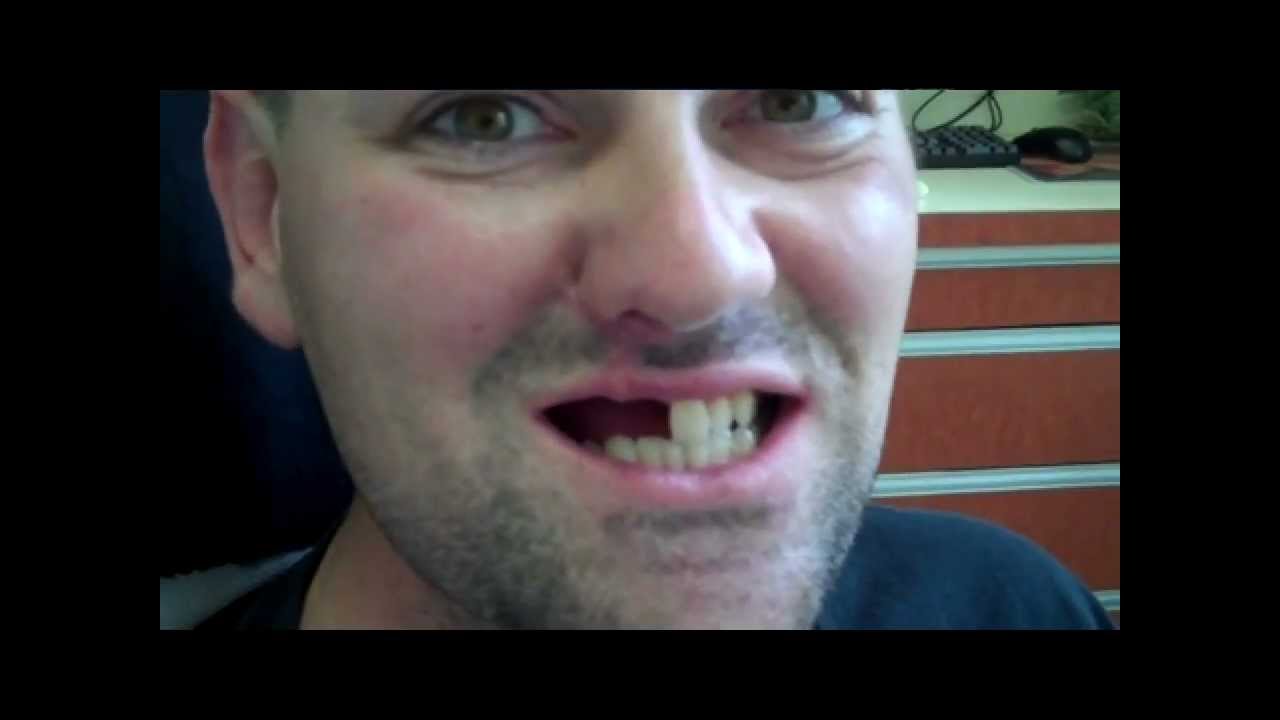 Dr. Abrahams - Andrew Linn: Emergency Patient Testimonial - YouTube