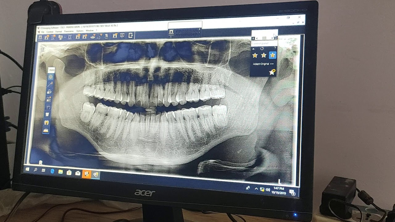 Operational Training Tutorial on OPG / OPG / Dental OPG / Carestream ...