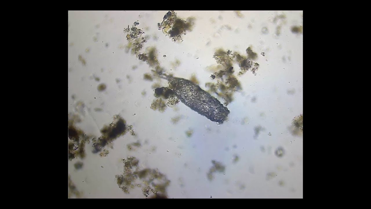 Difflugia giganteacuminata; bright field, dark field and oblique illumination - YouTube
