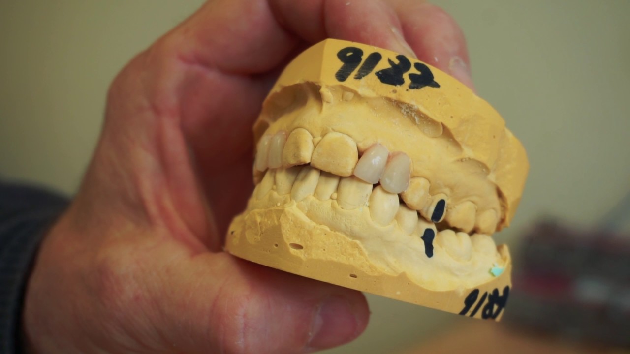 Ronan Kelly's Ireland Selling Second hand False Teeth in Limerick - YouTube