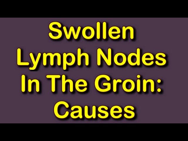 Swollen Groin Lymph Nodes Std