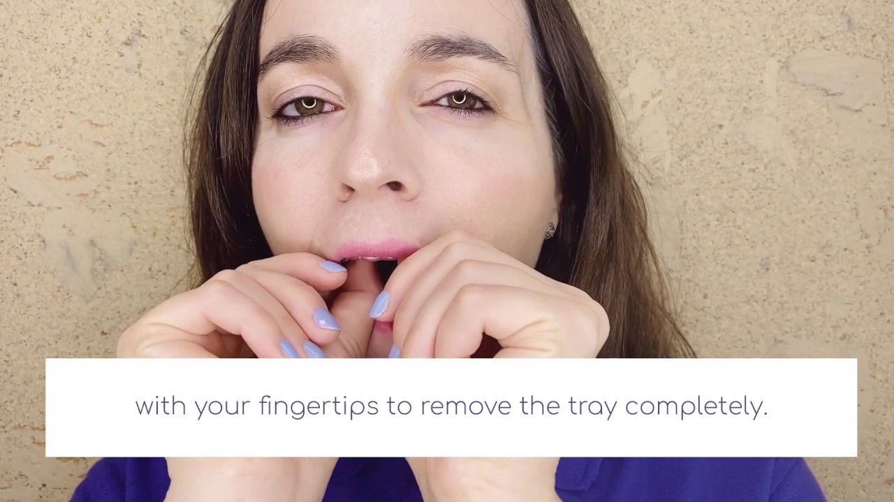 How to Insert and Remove Your Invisalign® Aligners - YouTube