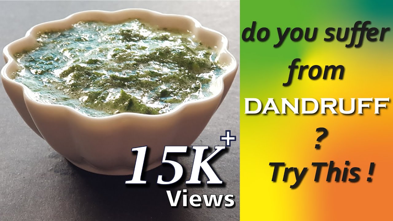 DANDRUFF treatment at home | How to get rid of dandruff at home | Home ...