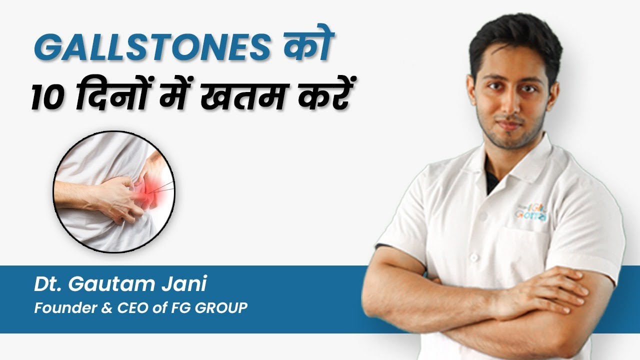 What Is Gallbladder Stone | Treat Gallbladder Stone In 10 Days | Diet ...