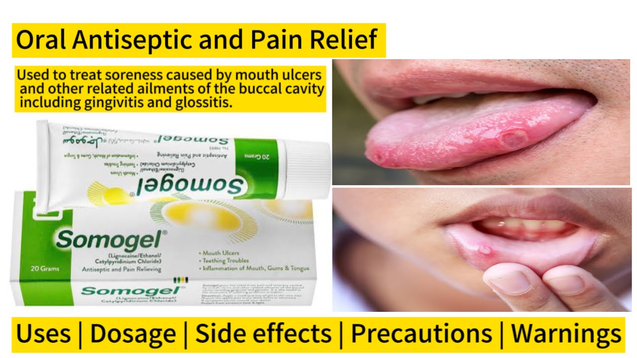 Somogel | Oral Antiseptic | Pain killer | Mouth ulcers | Use | Dose ...