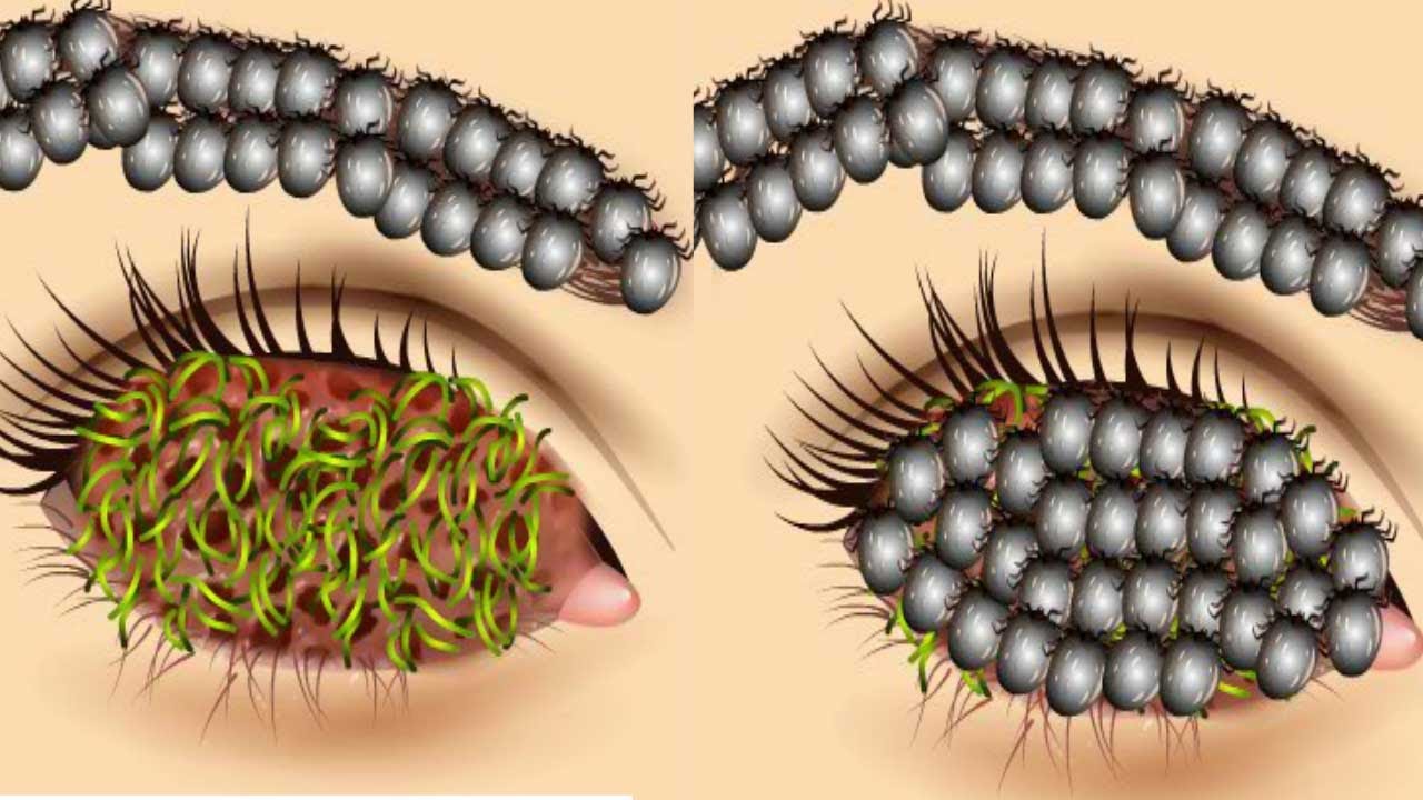 Dirty Eye Deep Cleaning Animation | ASMR Removal Dog Ticks & Maggot ...