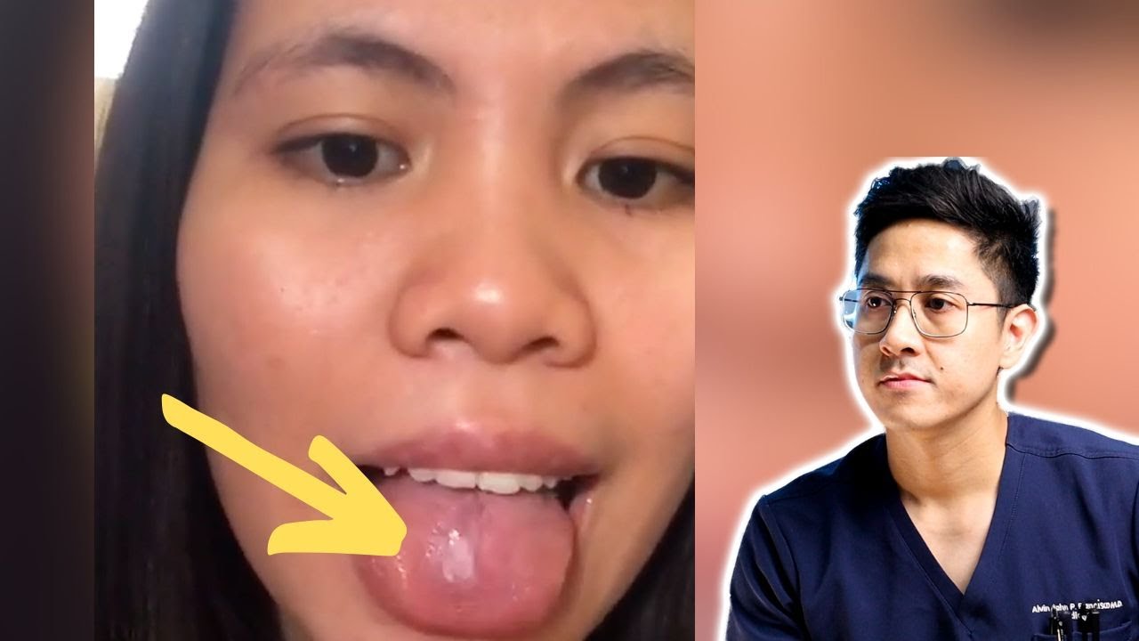 BABAE, NAOPERAHAN DAHIL SA SINGAW. ALAMIN KUNG BAKIT - YouTube