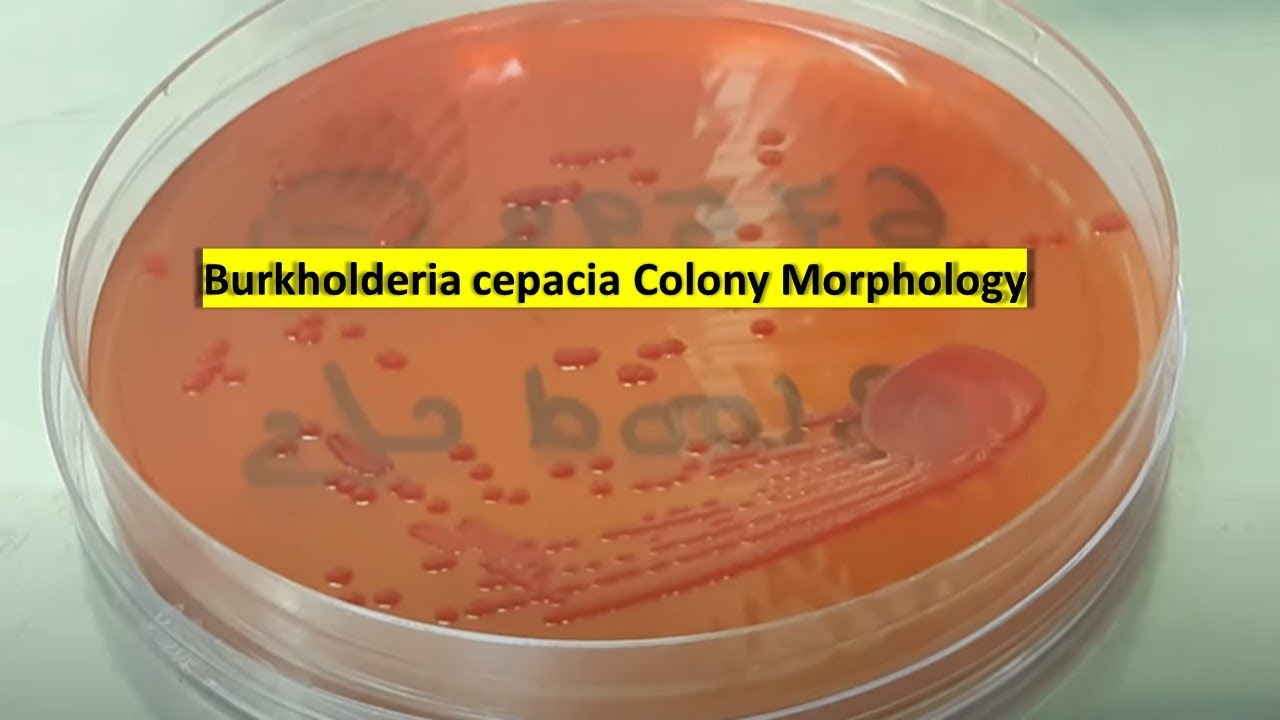Burkholderia cepacia growth on Macconkey agar - YouTube