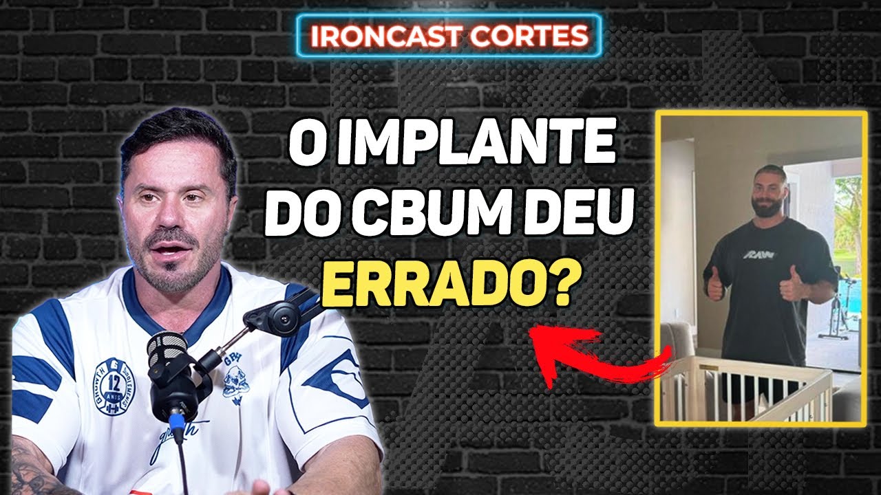 O IMPLATE CAPILAR DO CBUM NÃO DEU CERTO? CARIANI COMENTOU – IRONCAST ...