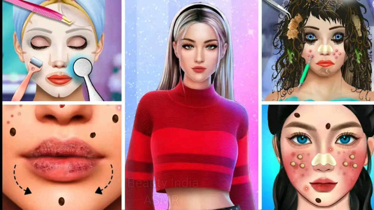 ASMR Removel Big Acne Infection Face or Pimple | Deep Cleaning ...