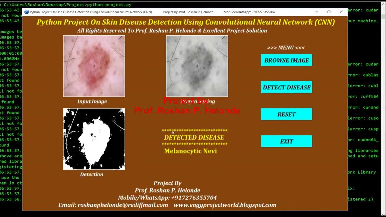 Python Code for Skin Disease Detection Using CNN (Convolutional Neural ...