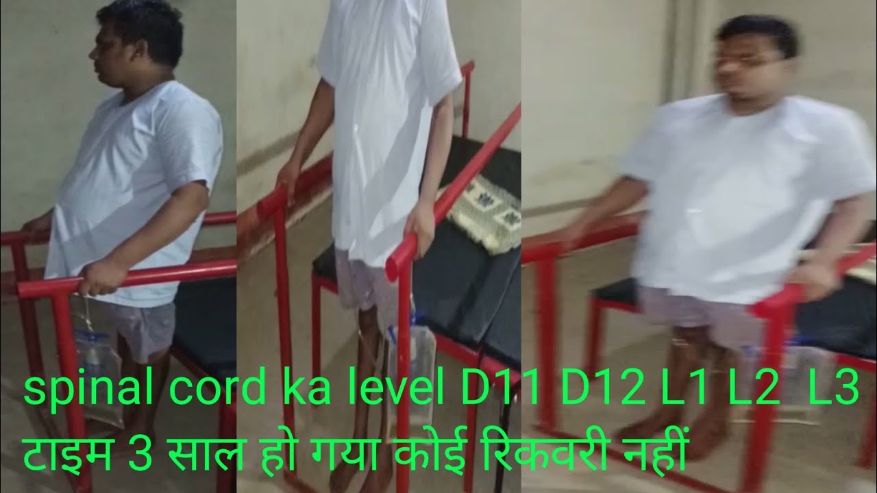 Spinal Cord Injuries D11, D12,L1, L2 L3 Vertebrae Explained Paralysis ...